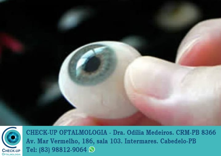 Prótese ocular – Dra. Odília Navarro M. Viana